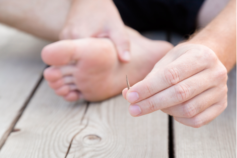DIY Ways to Remove Foreign Objects From Your Skin at Home | State ...